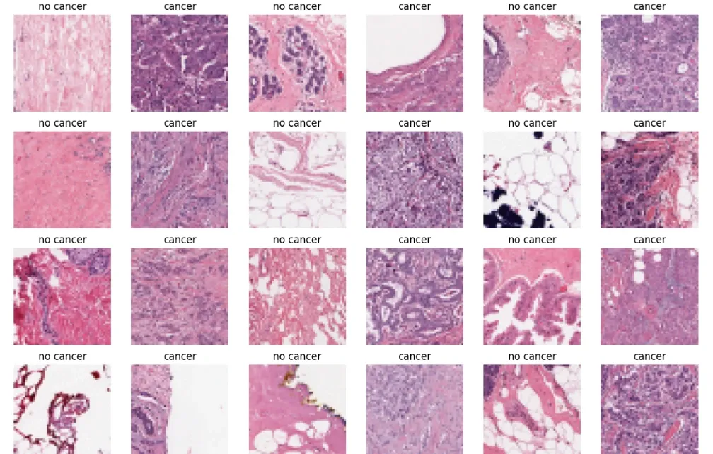 Breast Cancer Detection Model: Tutorial to Analyze Mammography Images