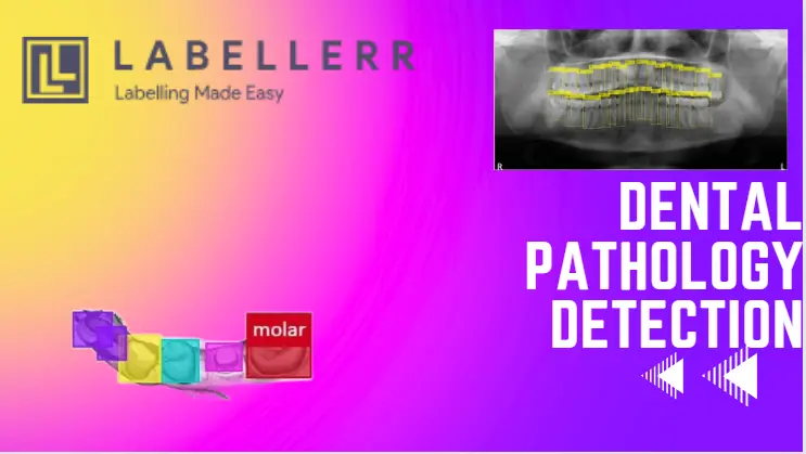 Automate Dental Image Annotation With Labellerr Using SAM